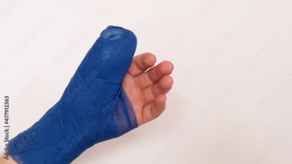 Vidéo Stock Bandaged hand.Blue surgical bandage on the arm on a white ...