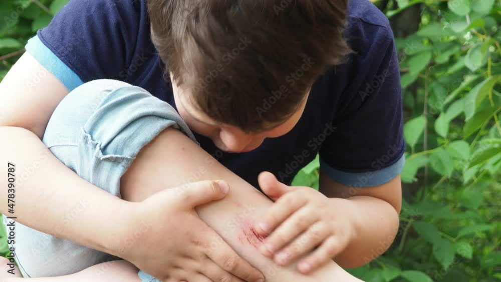 Closeup of injured young kid's knee after he fell down on pavement. the ...