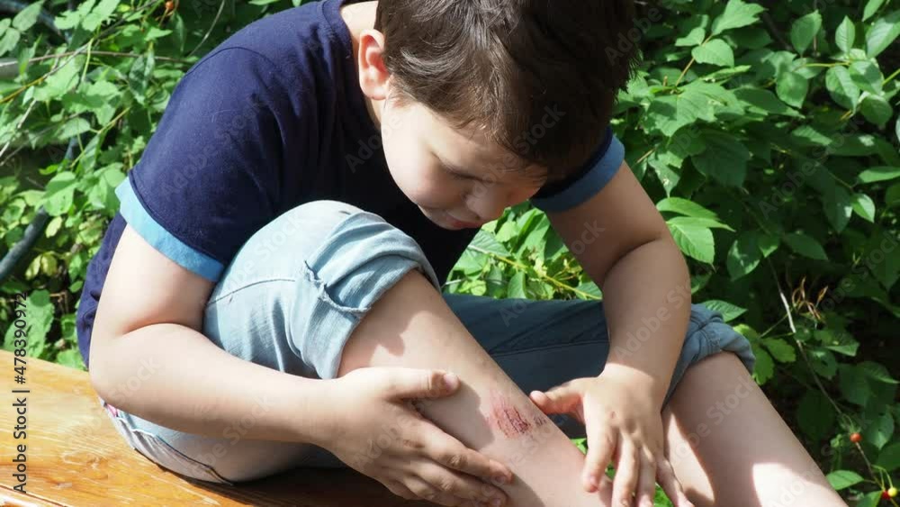 Closeup of injured young kid's knee after he fell down on pavement. the ...