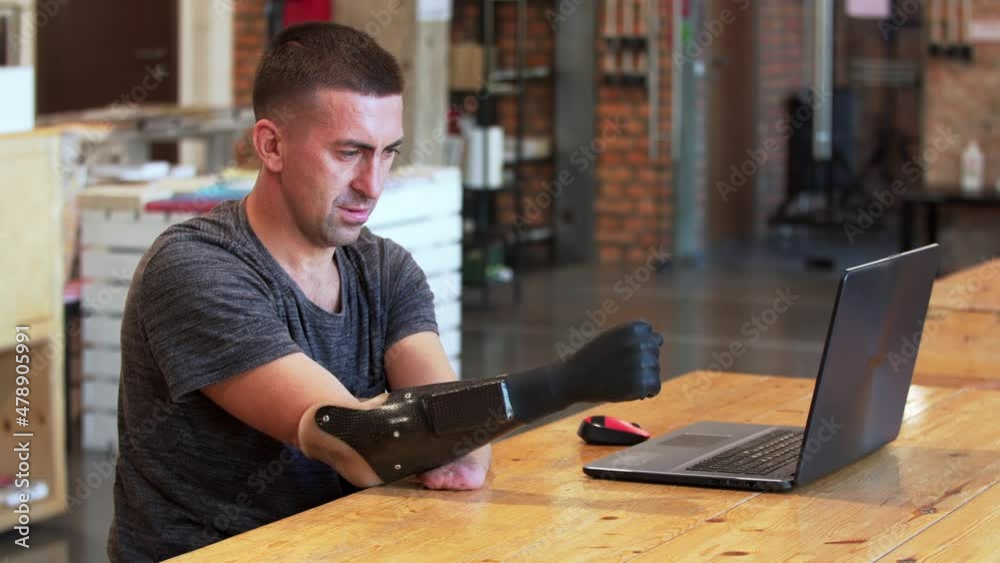 A man living with a disability with amputated two stump hands is trying ...