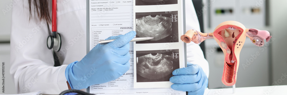 Gynecologist shows ultrasound of uterus in office closeup Stock Photo ...