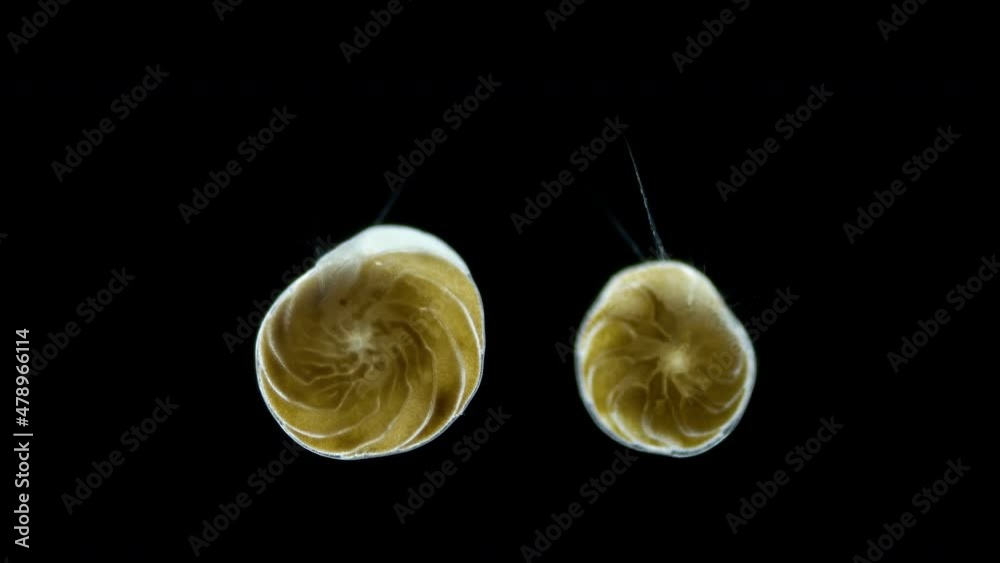 Foraminifera under a microscope, class Rotaliata, possibly order ...