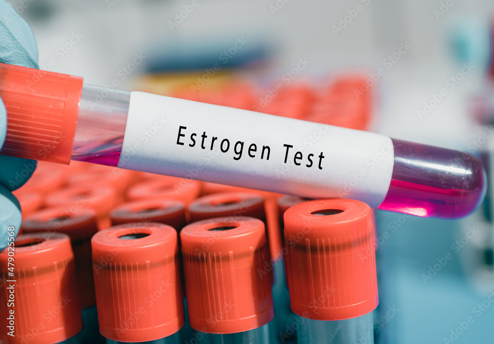 Ovaries Estrogen Hormones Affects Test development of female sexual ...