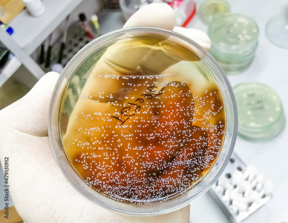 Colonies of Candida albicans from urine sample on agar media plate ...