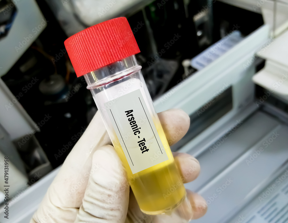 Poster Urine sample for arsenic (heavy metal) test, toxic metal – Wall ...