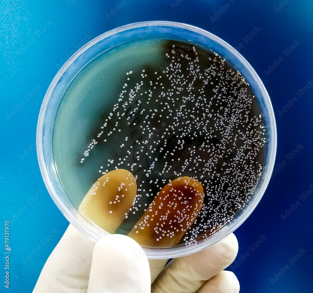 Colonies of Candida albicans from urine sample on agar media plate ...