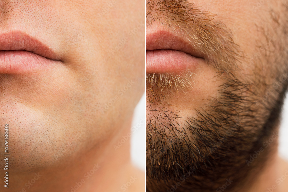 Close up photo of a man's face before and after shaving. a young man ...