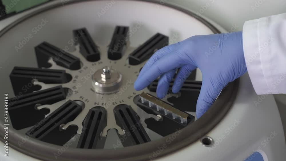 a machine for separating blood into components, close-up. production of ...