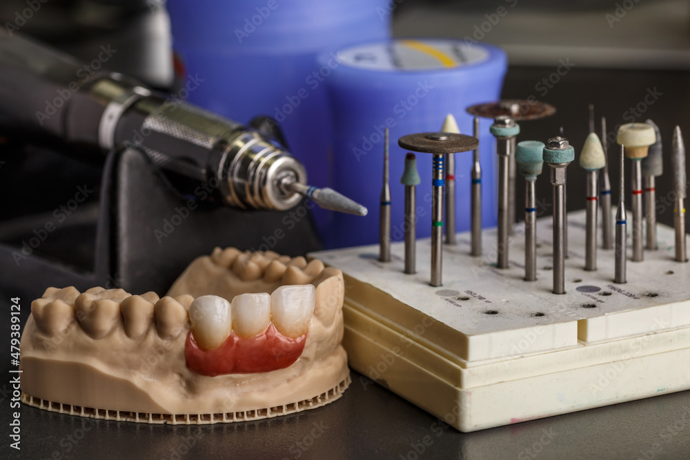 Dental implant. Restoration of teeth. Dental surgeon. Dental laboratory ...