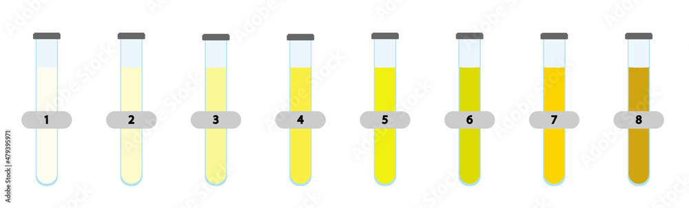 Urine Color scale chart. Scale to analyse the hydration of a patient ...