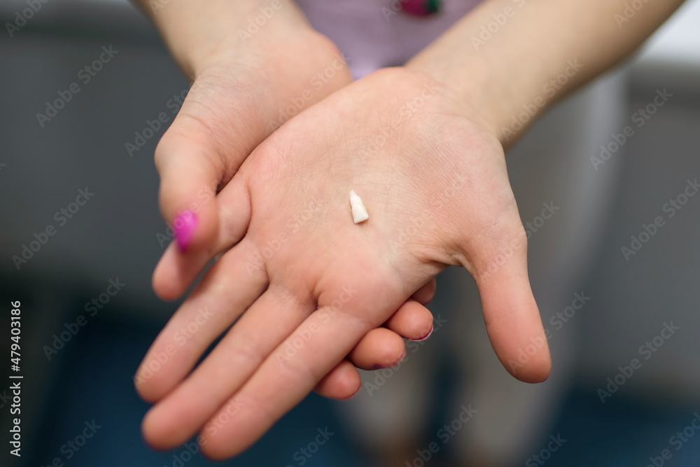 Milk tooth in the palm of a child close-up. The child holds his first ...