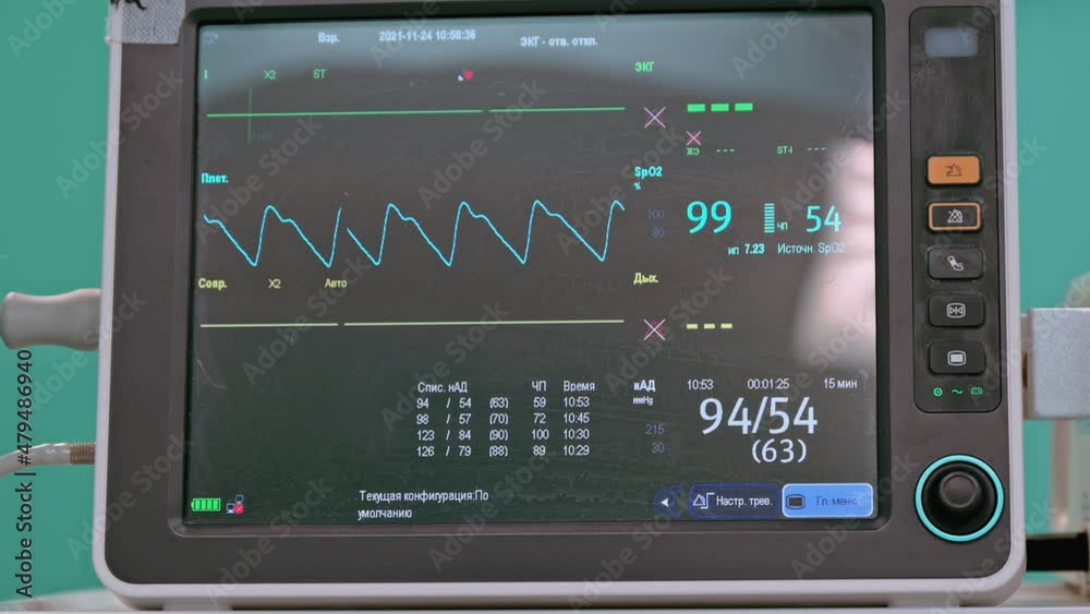 Screen of a monitor showing vital signs of a patient Stock Video ...