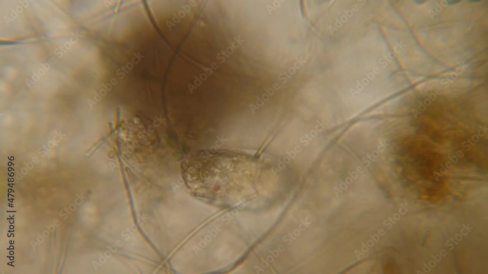 Nematode Worm Under Microscope, Parasites Among Roundworms: Roundworms ...