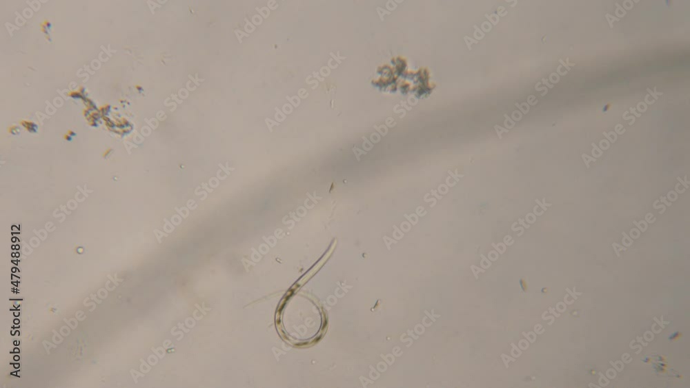 Nematode Worm Under Microscope, Parasites Among Roundworms: Roundworms ...