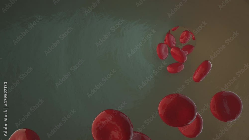 Vídeo do Stock: Narrowing of the arteries due to the formation of ...