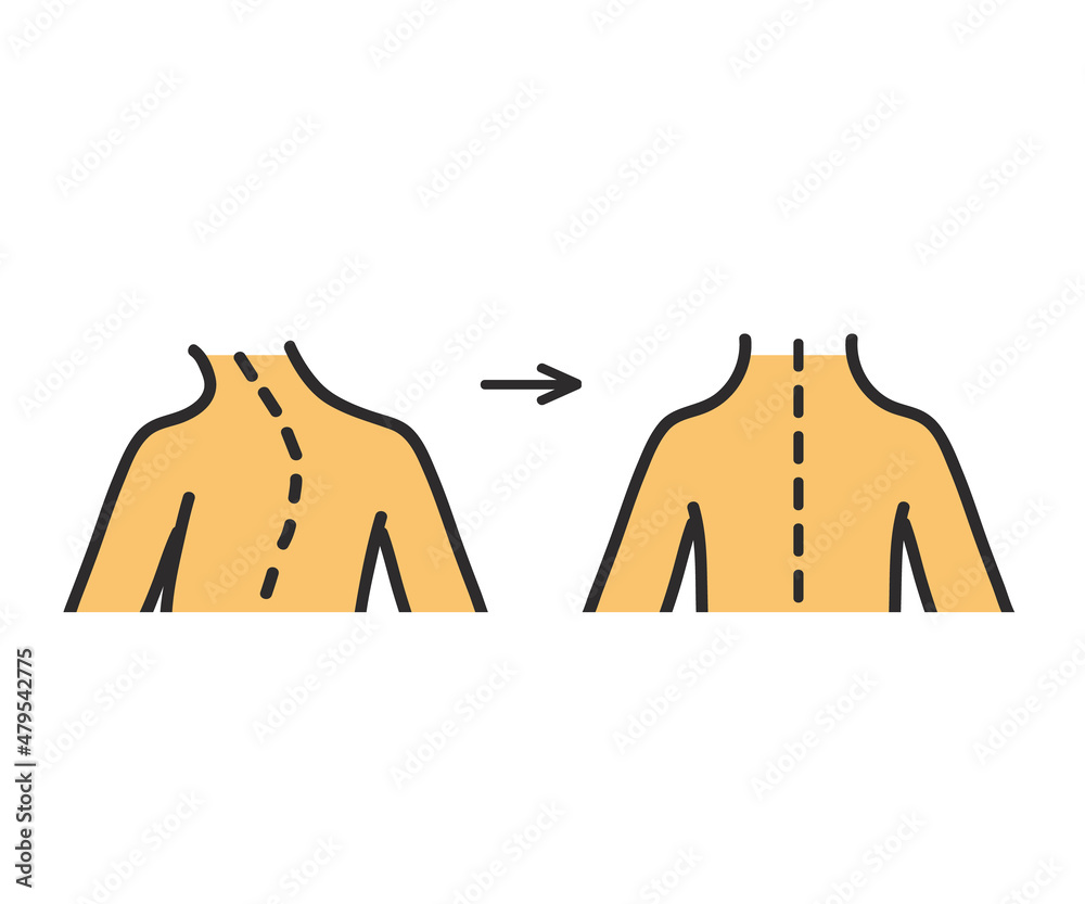 Curved human spine. Poor posture. Symbol. Vector illustration. Stock ...