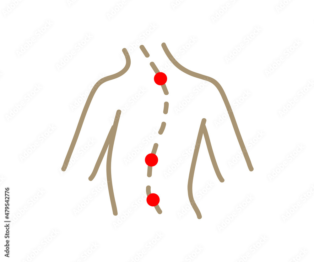 Curved human spine. Poor posture. Symbol. Vector illustration. Stock ...