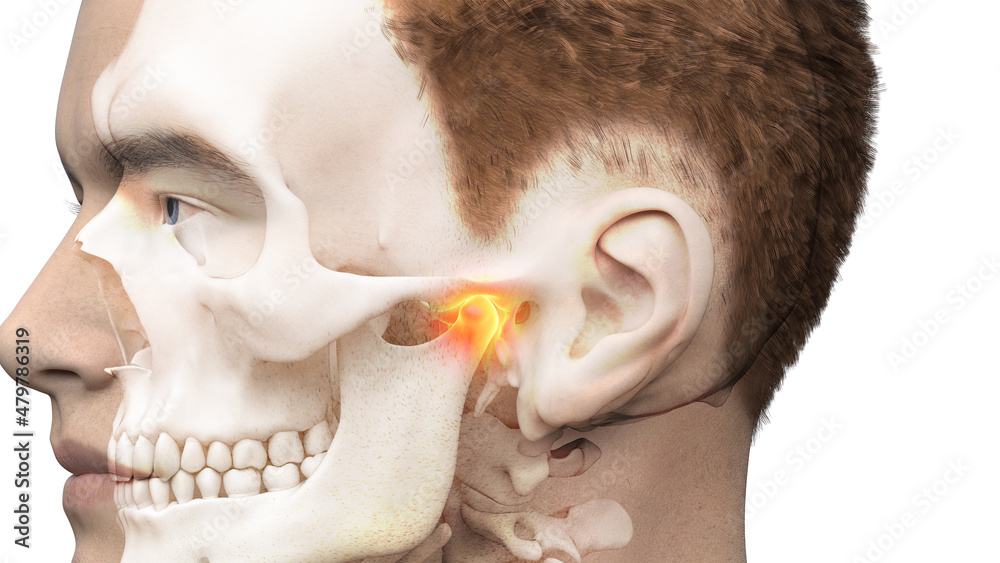 3d rendered illustration of a painful temporomandibular joint Stock ...