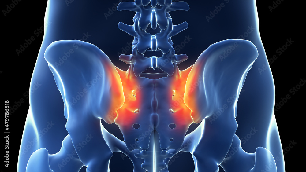 3d rendered illustration of a painful sacroiliac joint Stock ...