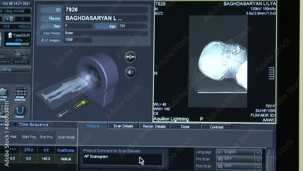 MRI scan screen animation. Computed medical tomography MRI. Diagnosis ...