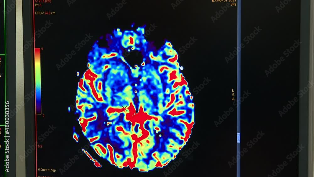 MRI scan screen animation. Computed medical tomography MRI. Diagnosis ...