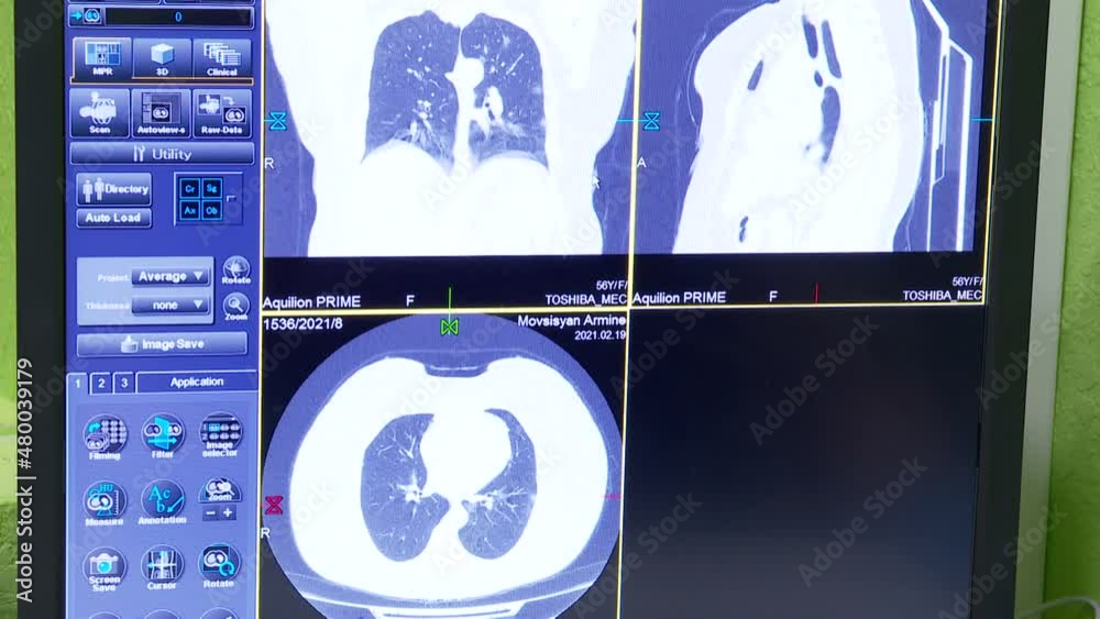 MRI scan screen animation. Computed medical tomography MRI. Diagnosis ...