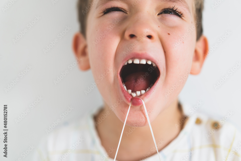 Cute boy pulling loose tooth using a dental floss. The boy's first milk ...