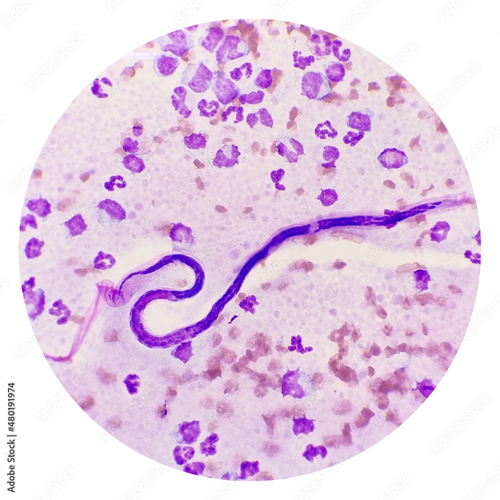 Microscopic examination of stained blood films used to differentiate ...