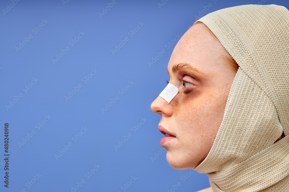 Side vies of unhappy woman with plaster over her nose and bandage on ...