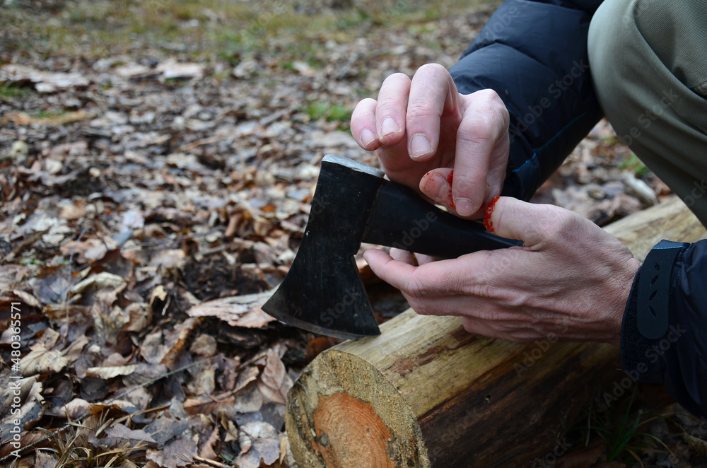 man injured with an ax while working with wood in the forest. blood and ...