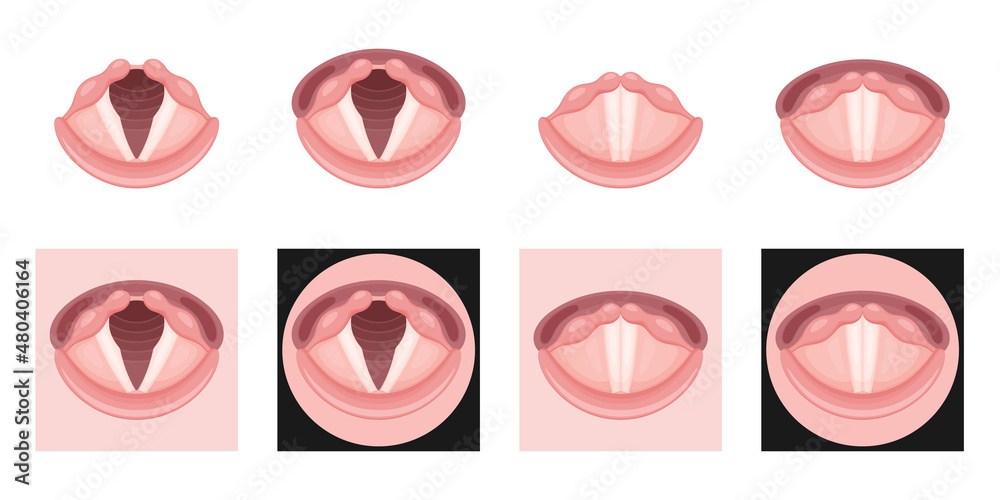 声帯のイラスト素材セット_リアル_呼吸時と発声時 Stock Vector | Adobe Stock