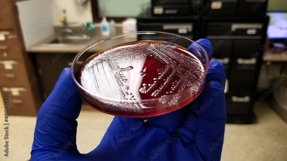 Blood agar culture plate with Salmonella colonies Stock Photo | Adobe Stock