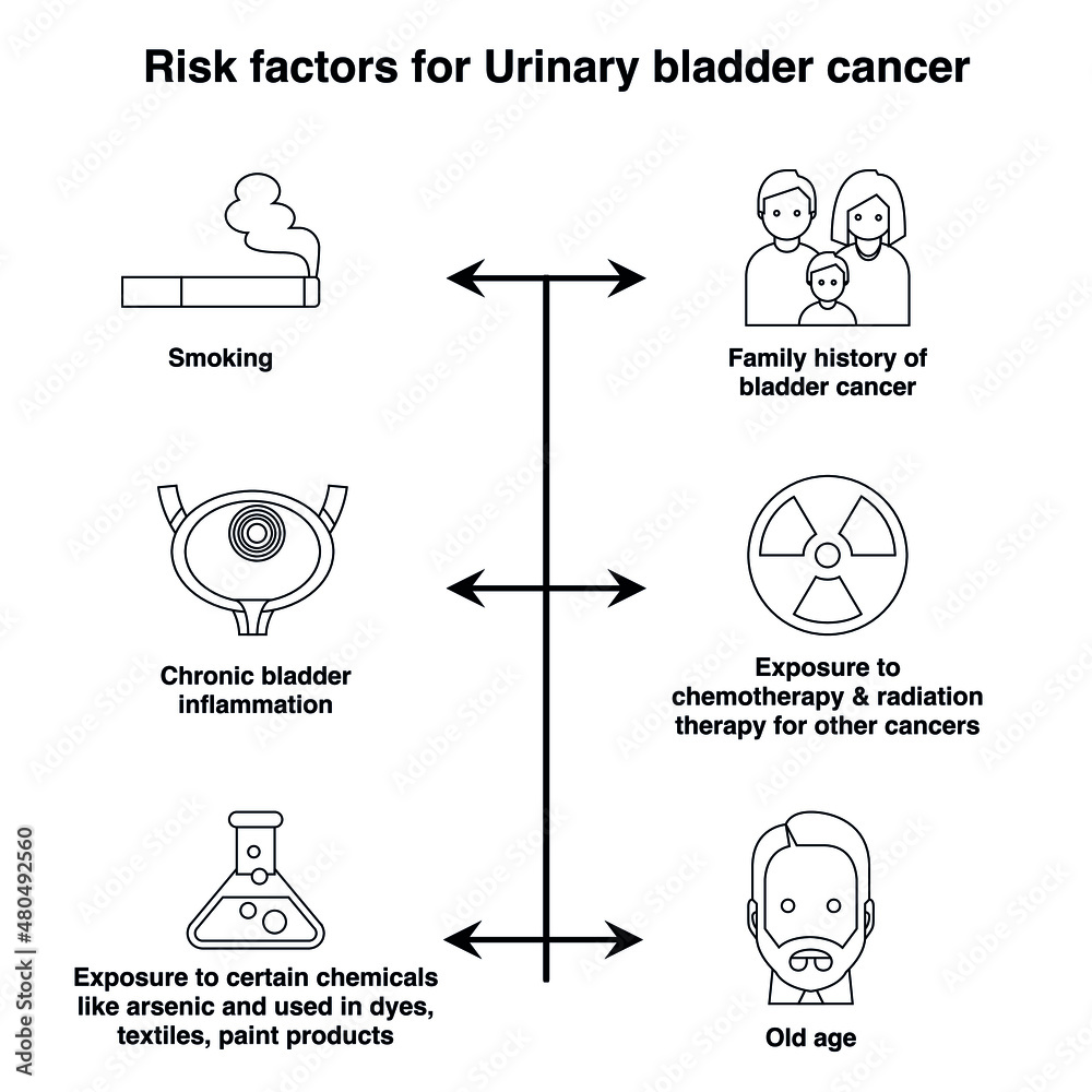 Risk factors for urinary bladder cancer outline flat vector icon ...
