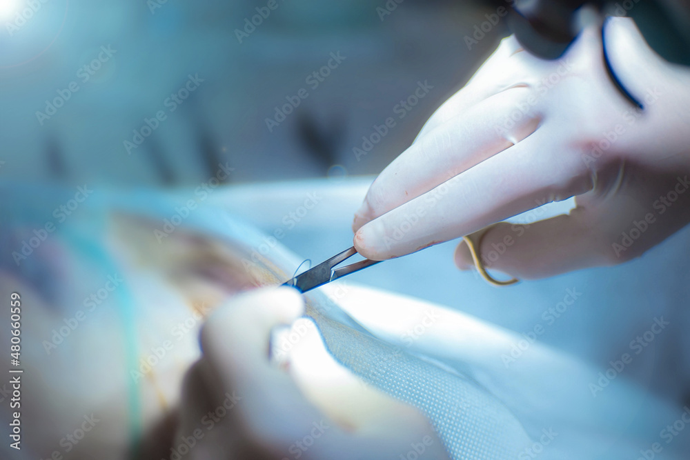 surgeon operates on the patient in the operating room, close-up hands ...