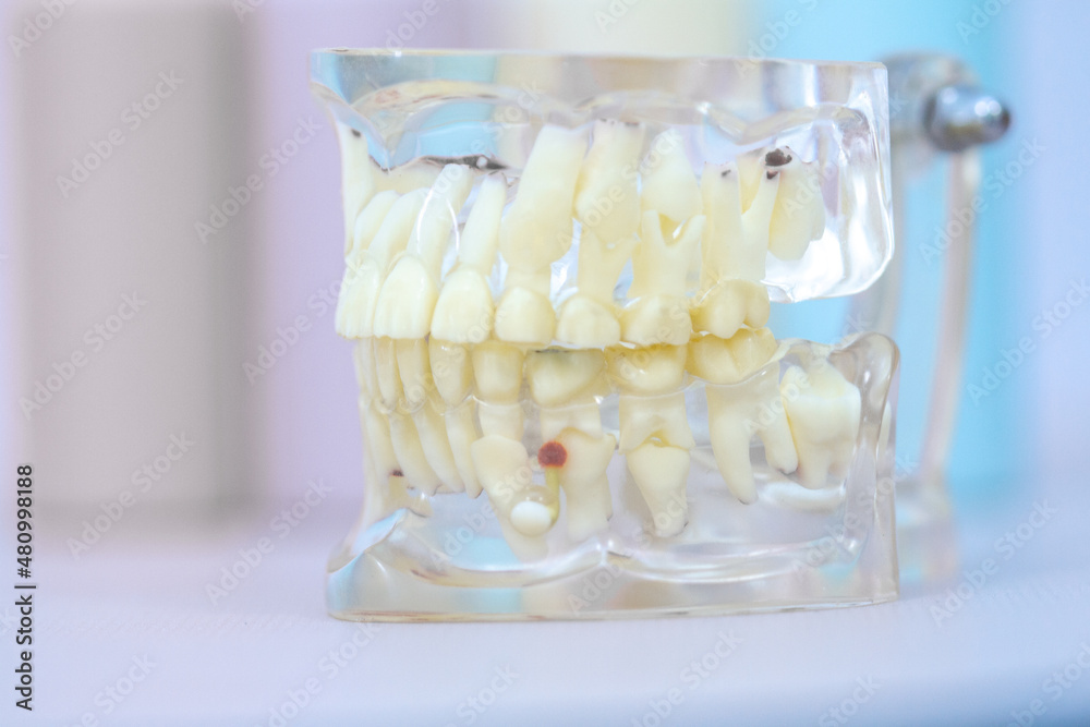 Silicone transparent model of the human jaw, side view, left side of ...