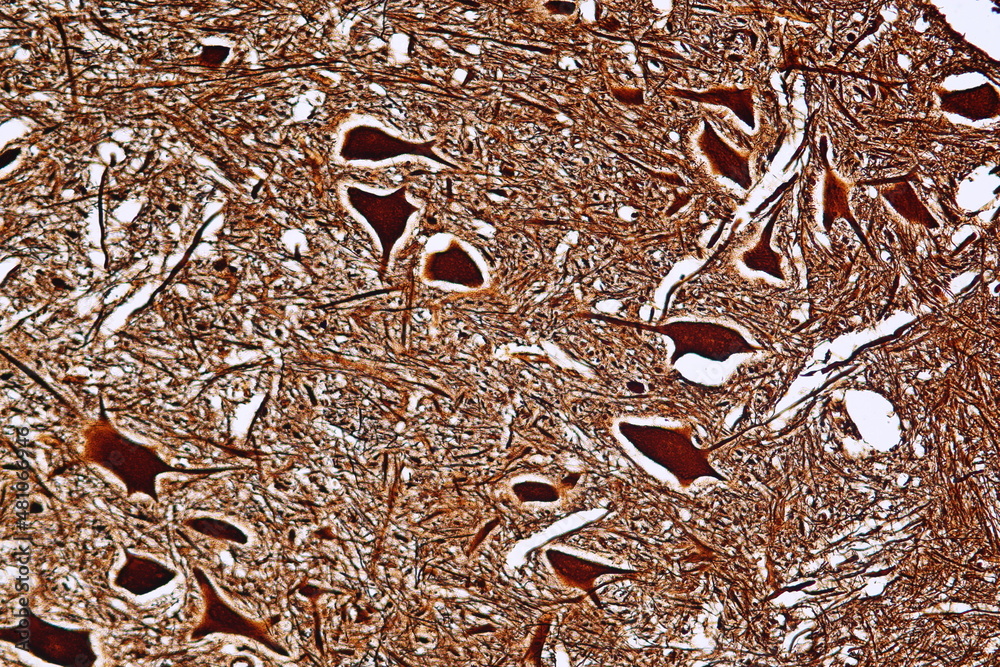 Motor Neuron and nerve cells under the microscope in Lab. Stock Photo ...