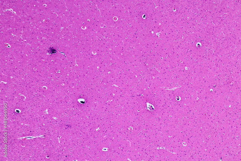 Motor Neuron and nerve cells under the microscope in Lab. Stock Photo ...