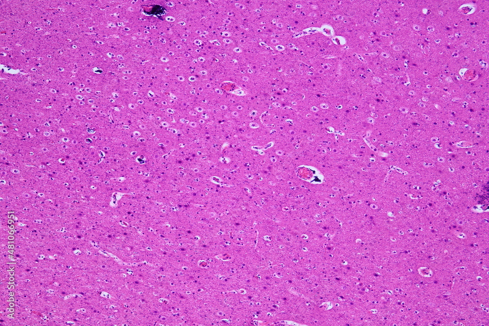 Nerve Cells Under A Microscope