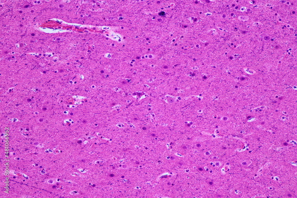 Motor Neuron and nerve cells under the microscope in Lab. Stock Photo ...