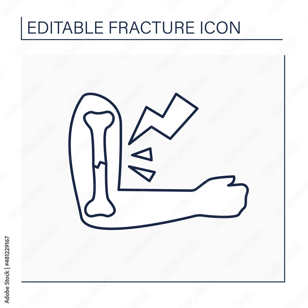 Oblique fracture line icon. Humerus fracture. Bone injury. Pain ...