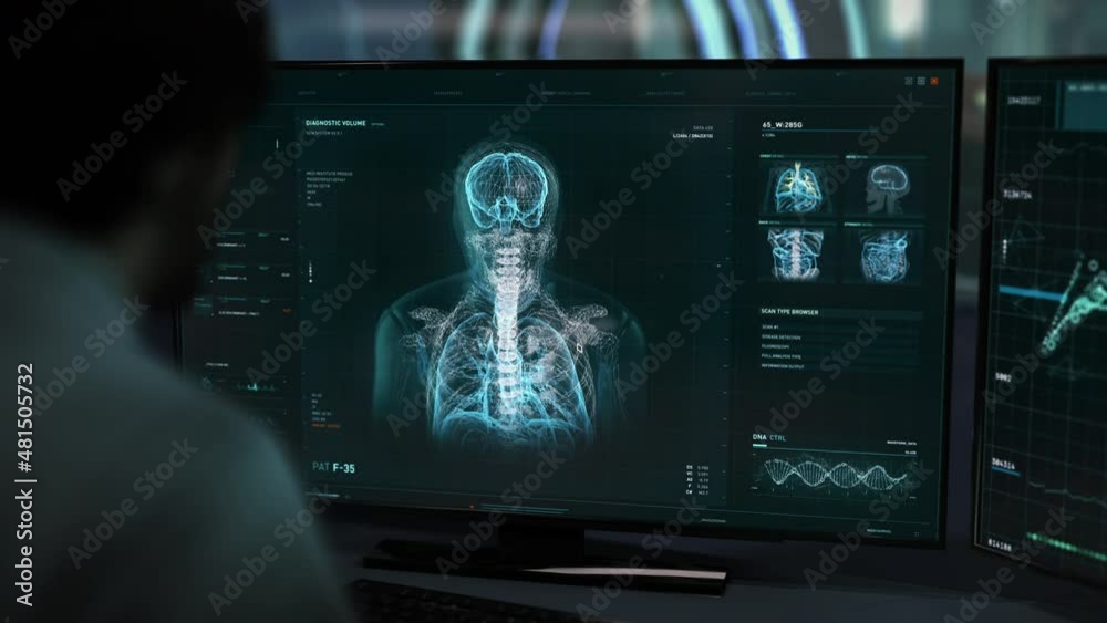 Doctor Uses X-Ray Software Interface To Analyze Patients Brain Health ...