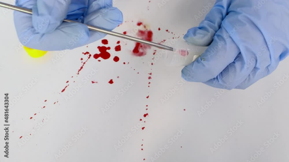 evidence idfresh splatter of red blood on white table, sharp knife ...