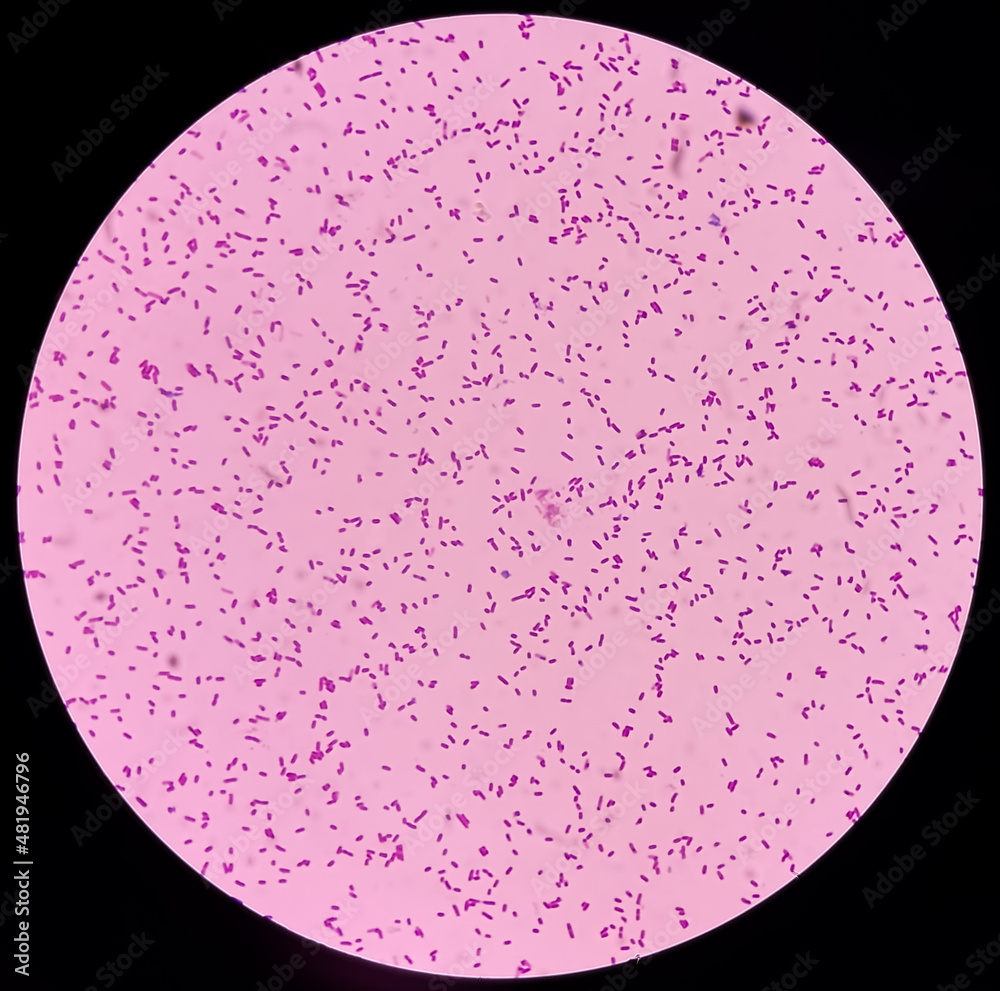 Escherichia coli bacterium, E.coli, gram-negative rod-shaped bacteria ...