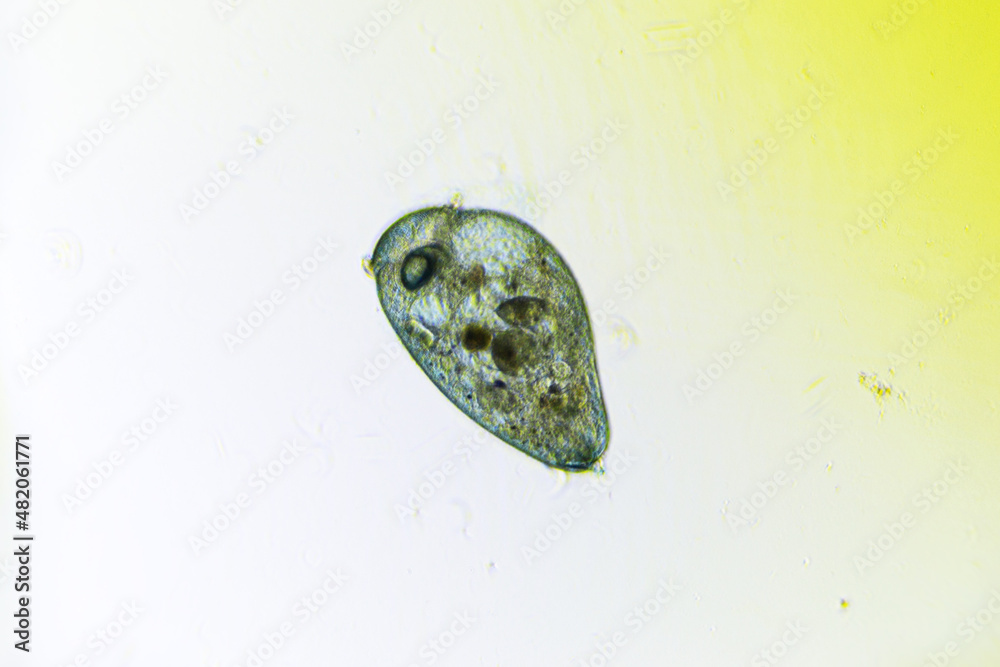 Ciliates Stentor
