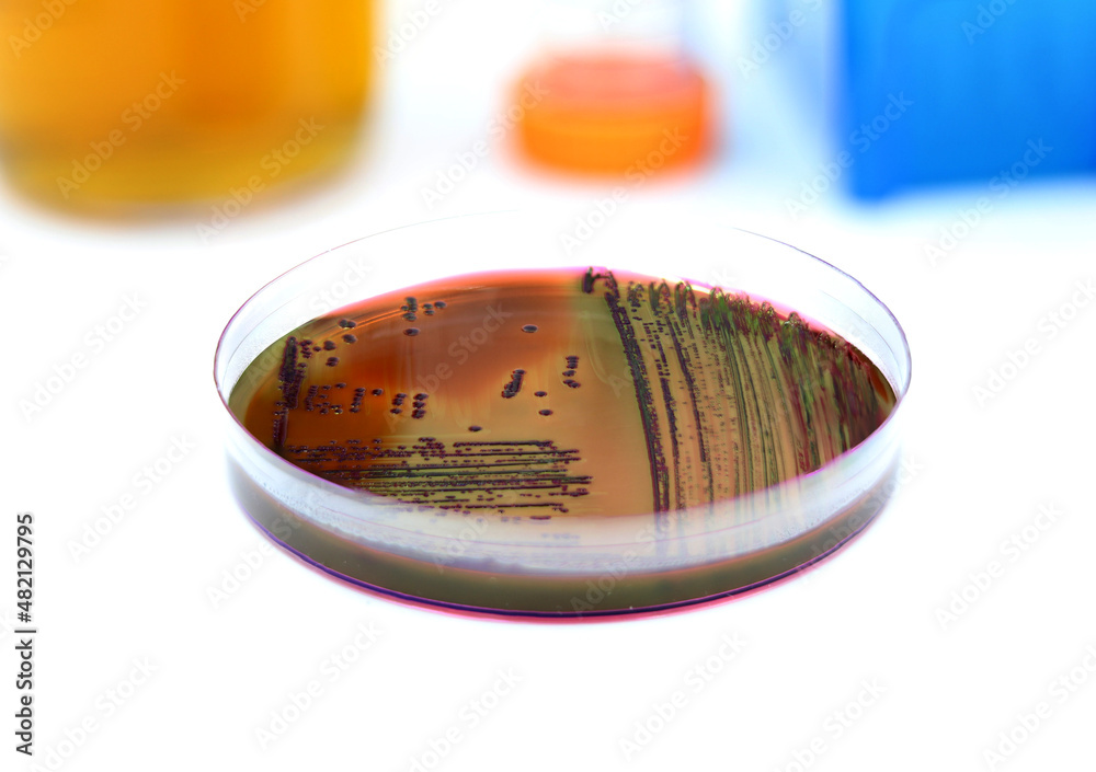 Escherichia coli bacteria growing on a selective medium in the ...