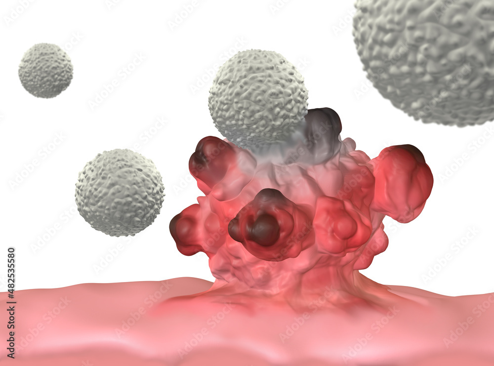3D rendering image of white blood cells attack and destroy cancer c ...
