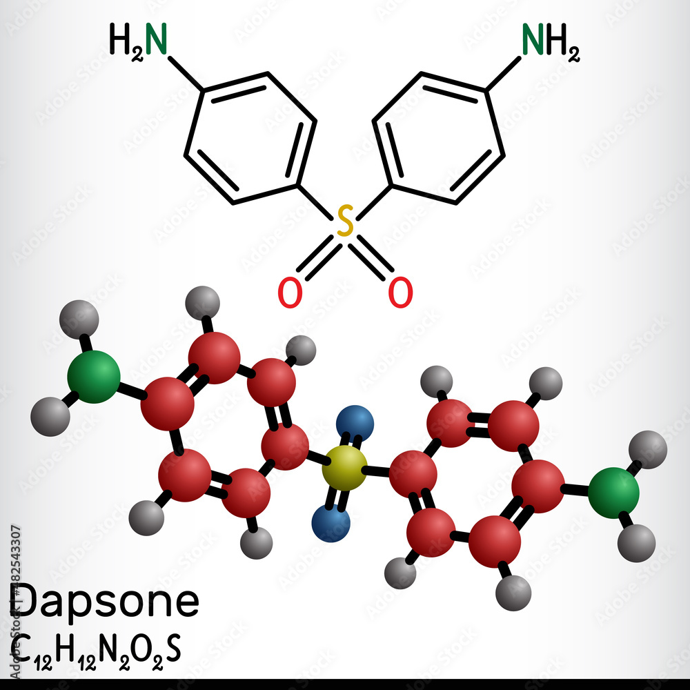 Dapsone, diaminodiphenyl sulfone, DDS molecule. It is sulfone ...