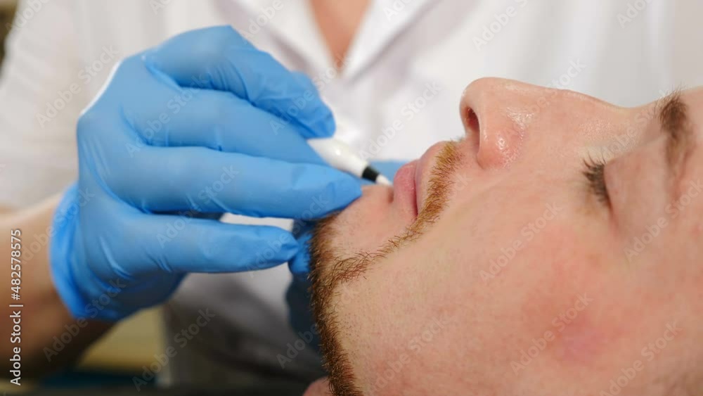 Cosmetologist marks face before beauty injection procedure. Doctor ...