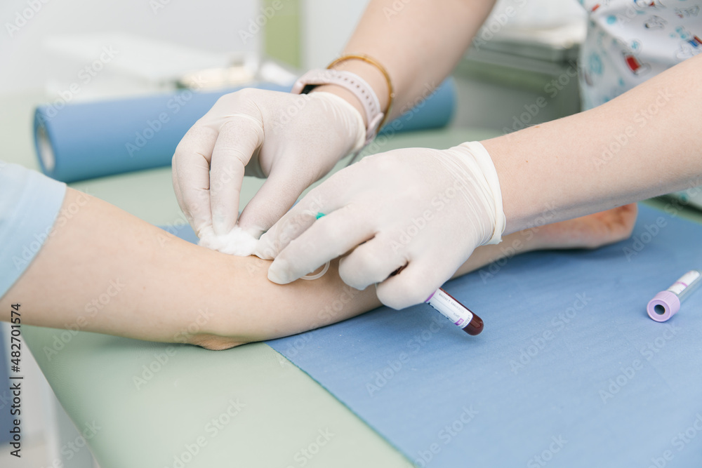 Taking a blood test from a vein in the treatment room. Nurse pricking a ...