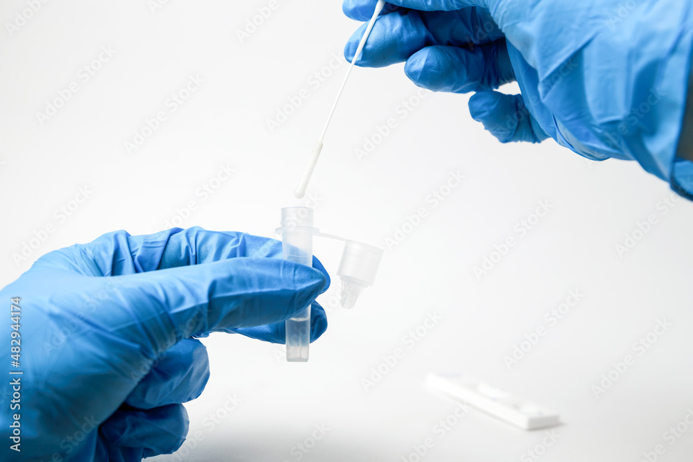 Man makes a covid-19 antigen pcr test macro. The test showed a positive ...